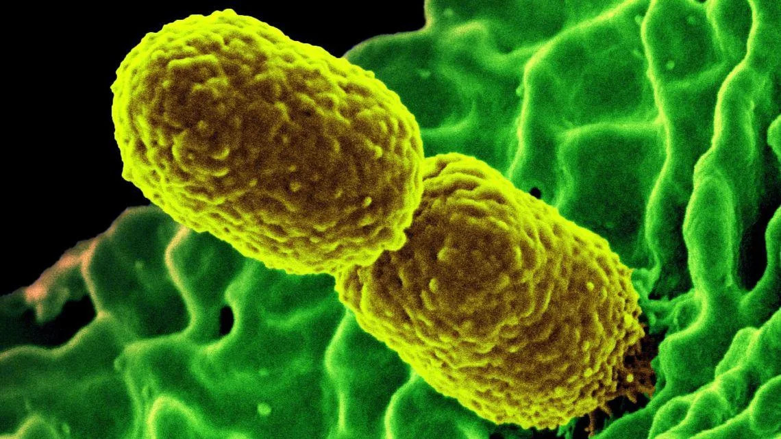 Global Research on AntiMicrobial resistance (GRAM) • Antimicrobial ...